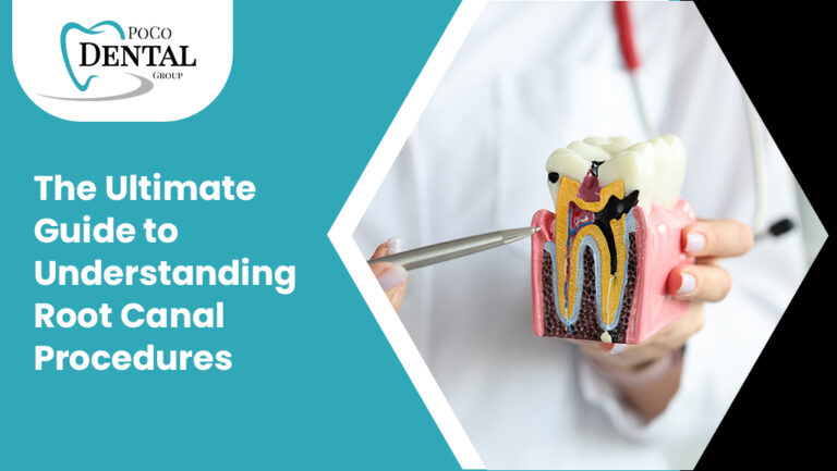The Ultimate Guide to Understanding Root Canal Procedures